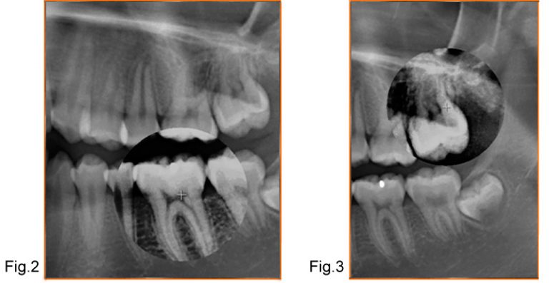 Centro Radiológico Dental Imagen www.dentalimagen.com.ec - Diagnóstico ...